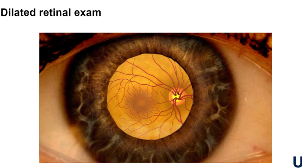 IDweek2023 | PRO: The Imperative of Dilated Retinal Exams in All ...