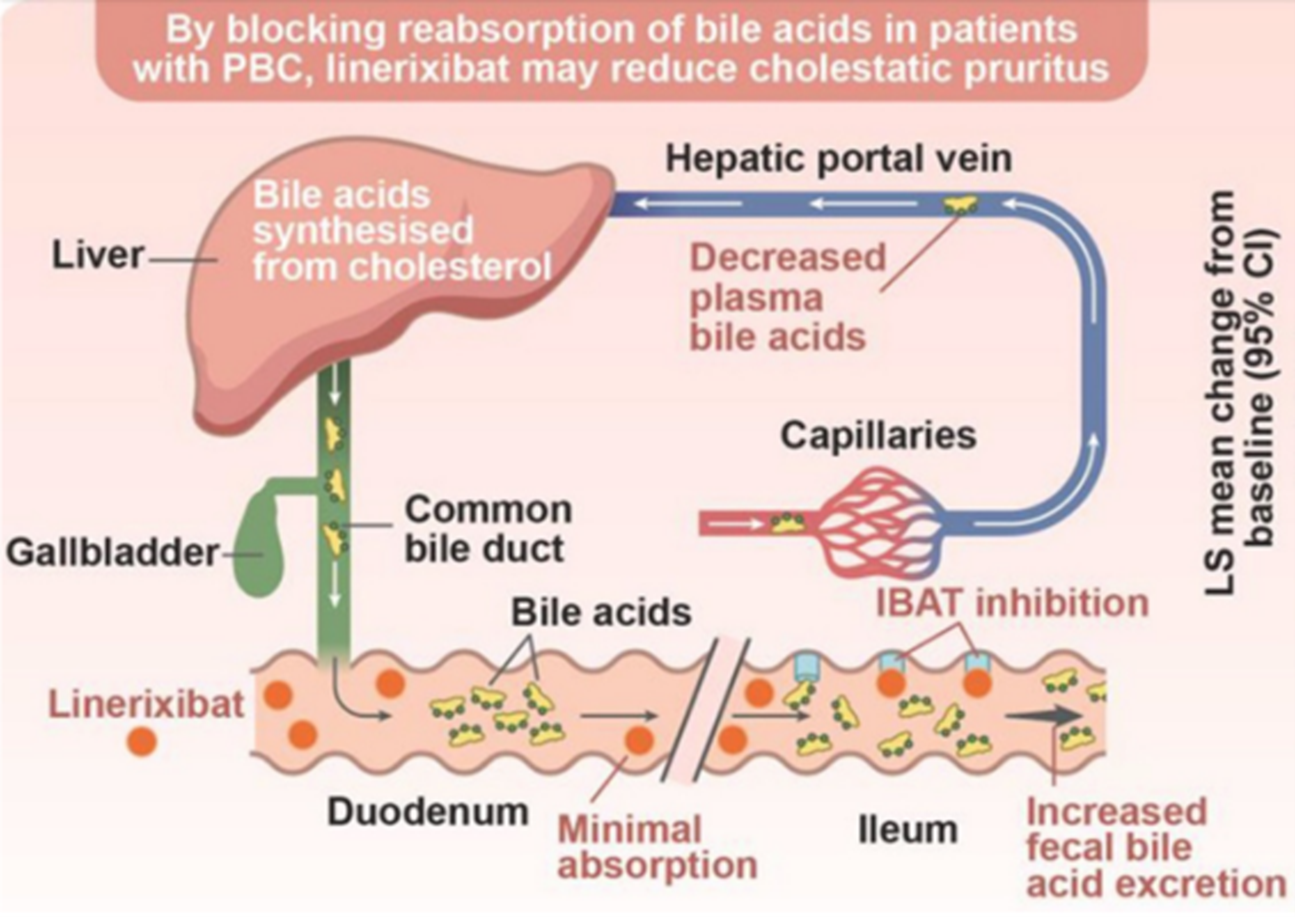 APASL 2023 | Prof. Jia Jidong: Latest Advances in Primary Biliary ...