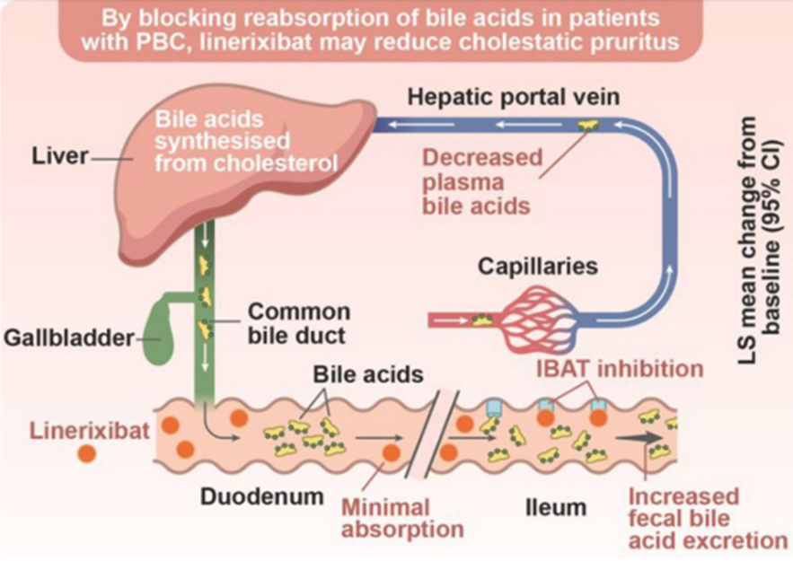 APASL 2023 | Prof. Jia Jidong: Latest Advances in Primary Biliary ...