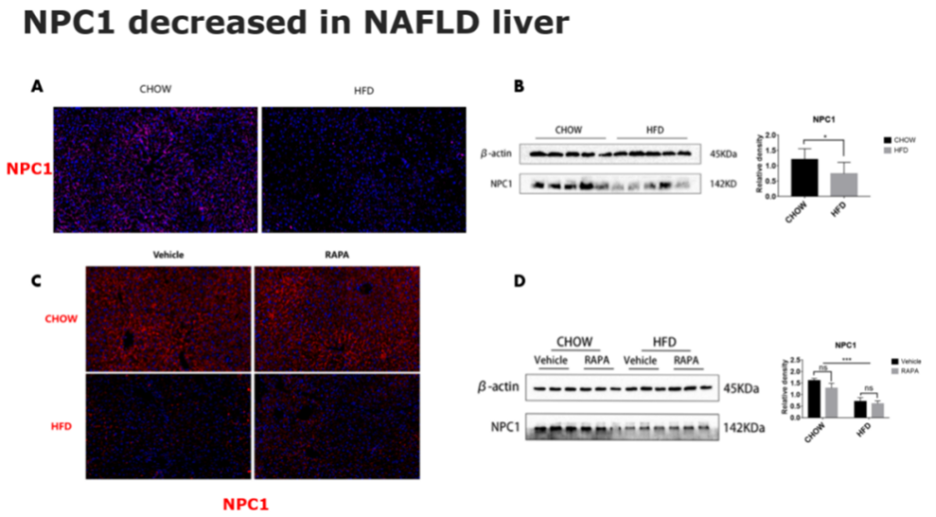 APASL 2023 | Prof. Ning Qin: New Strategies for Targeting Liver ...